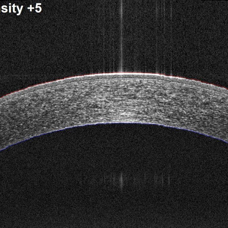 L'OCT-Angiographie : imagerie détaillée de la rétine - NIDEK France