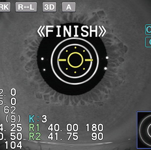 Auto-réfractomètre AR-F / ARK-F : mesure automatisée - NIDEK France