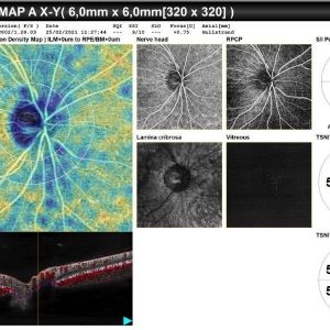 Retina Scan Duo 2 - NIDEK France